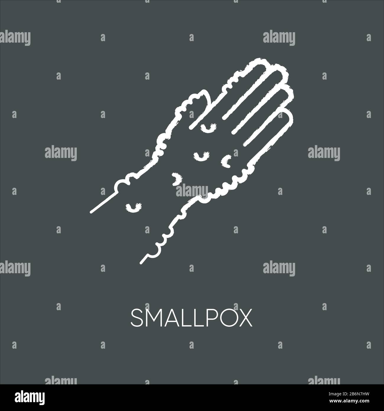 Smallpox chalk white icon on black background. Contagious ...