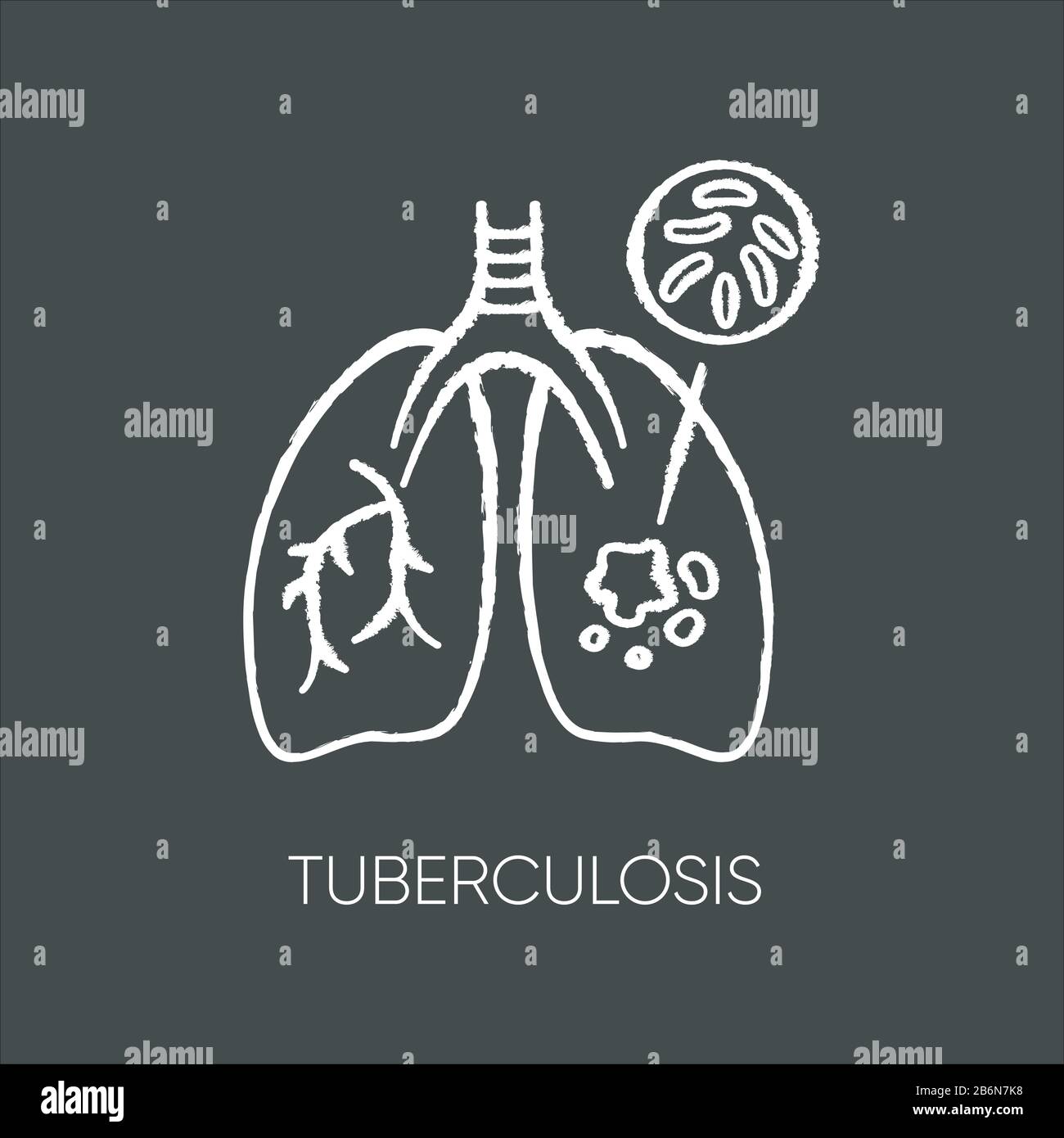 Tuberculosis chalk white icon on black background. Contagious ...