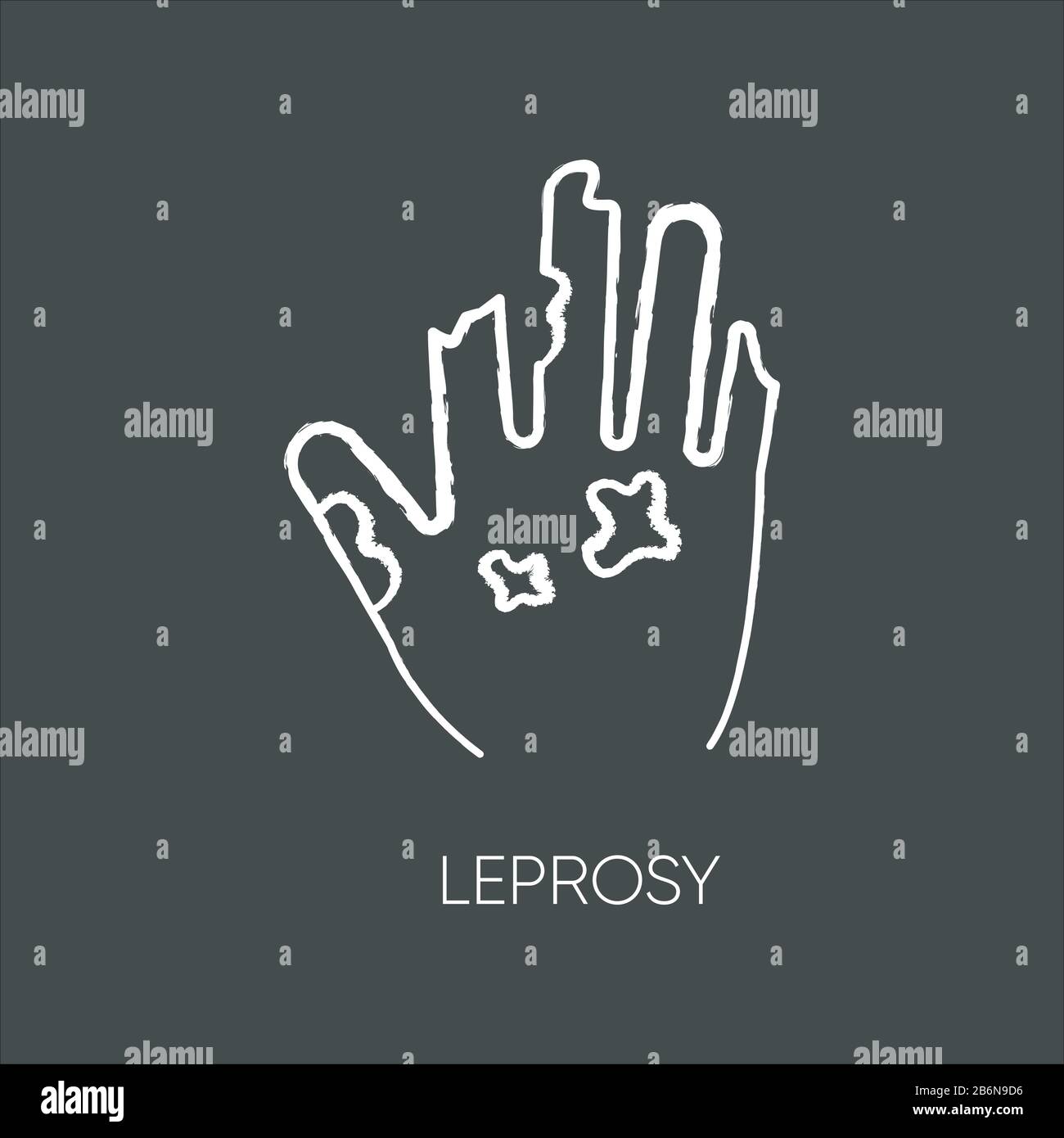 Leprosy hand hi-res stock photography and images - Alamy
