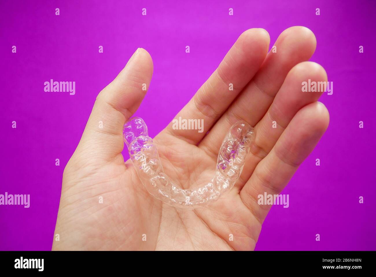 hand holding clear plastic retainer teeth that isolated on purple ...