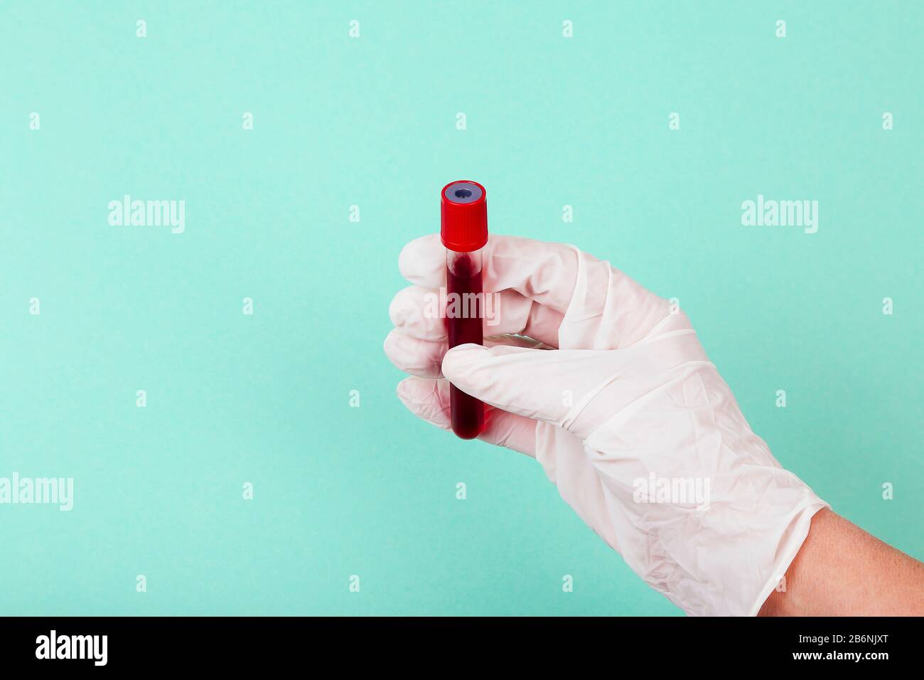 Hand Holding Blood Sample in Test Tube. Coronavirus Concept Stock Photo ...