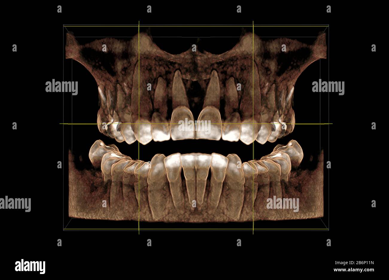 Tomogram hi-res stock photography and images - Alamy