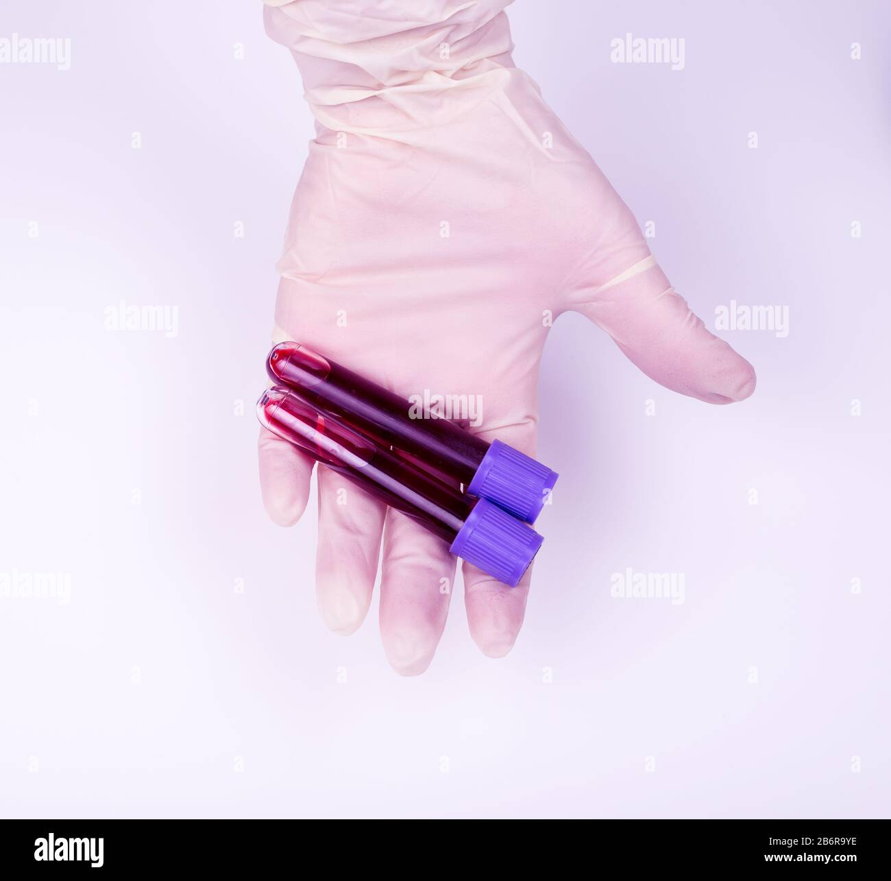 Human hand holding blood test semple in lab. Coronavirus 2019-nCoV ...
