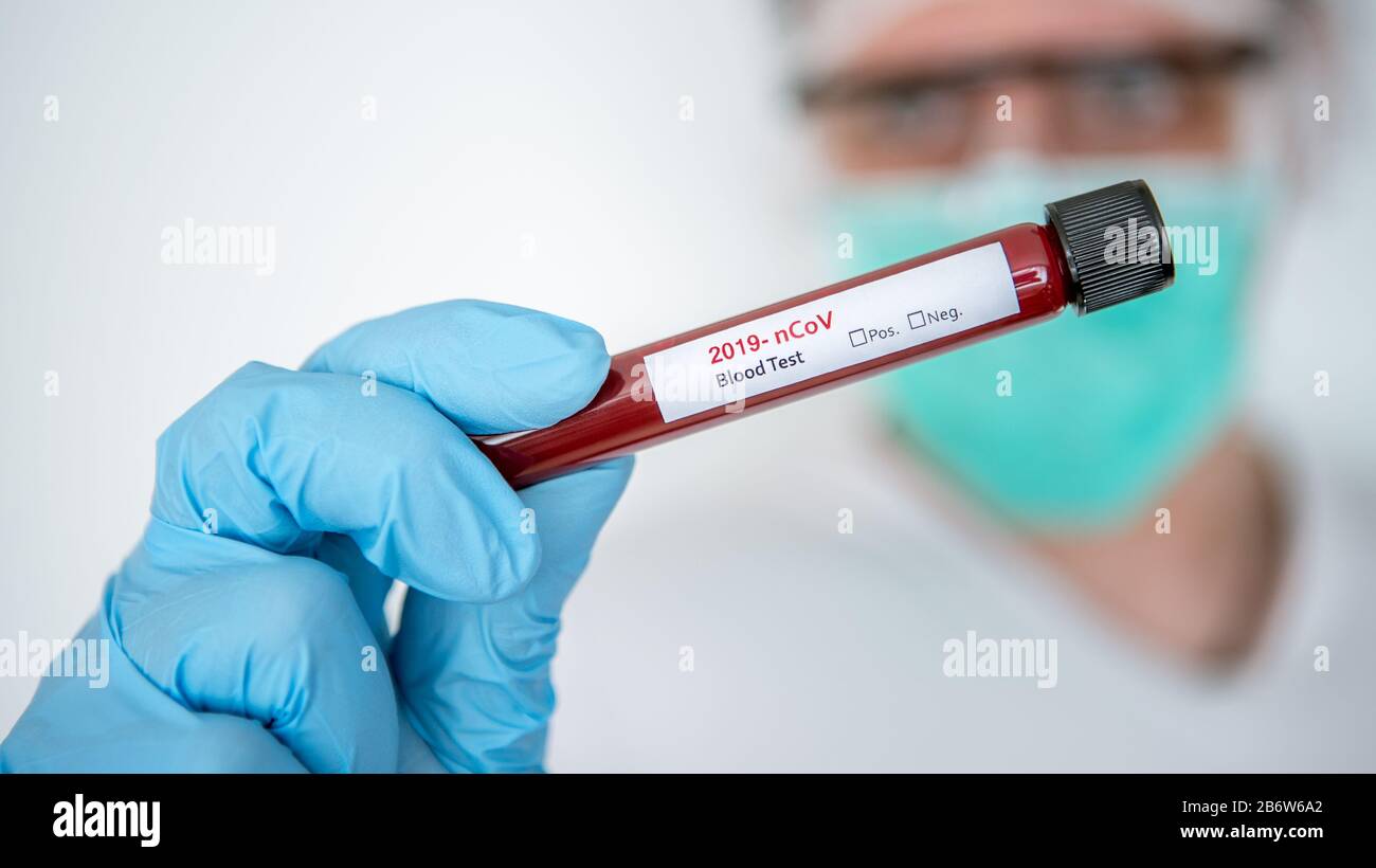 Scientist with coronavirus Covid 19 infected blood sample in tube ...
