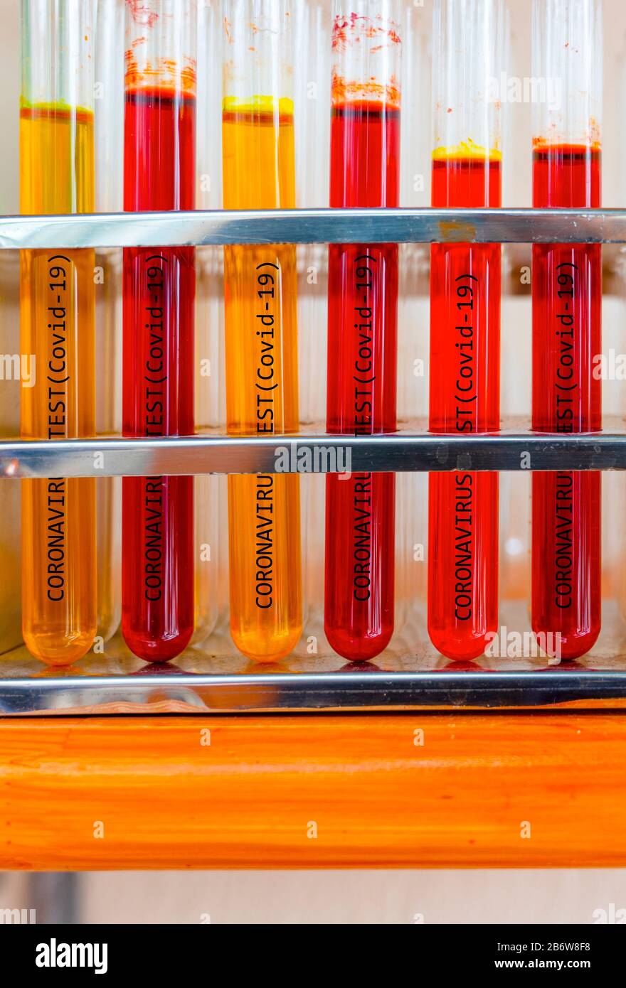 Blood tubes hi-res stock photography and images - Alamy