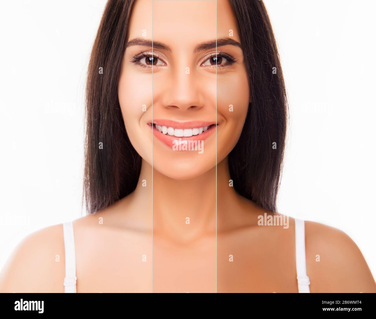 Brunette happy woman face with different color skin Stock Photo - Alamy