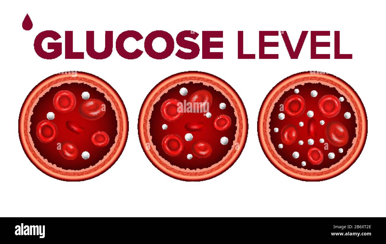 Red blood cells diabetic hi-res stock photography and images - Alamy