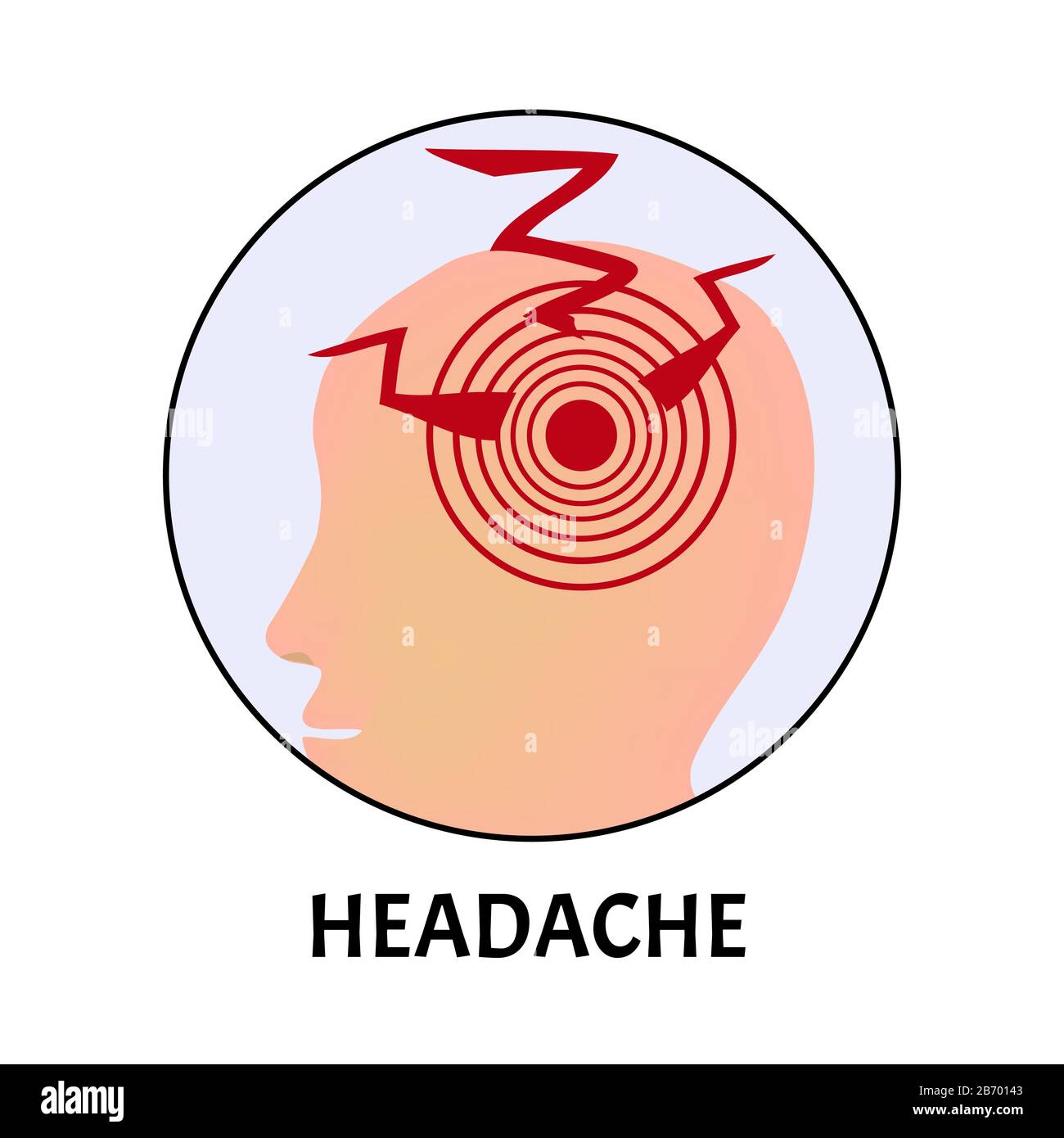 Headache. Symptom of influenza, allergies, bronchitis, pneumonia ...