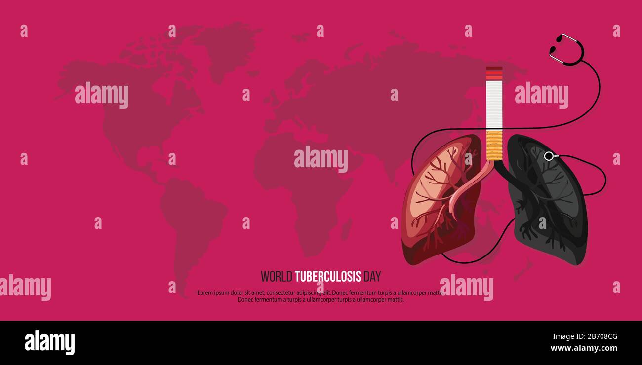 Tuberculosis Awareness High Resolution Stock Photography and Images - Alamy