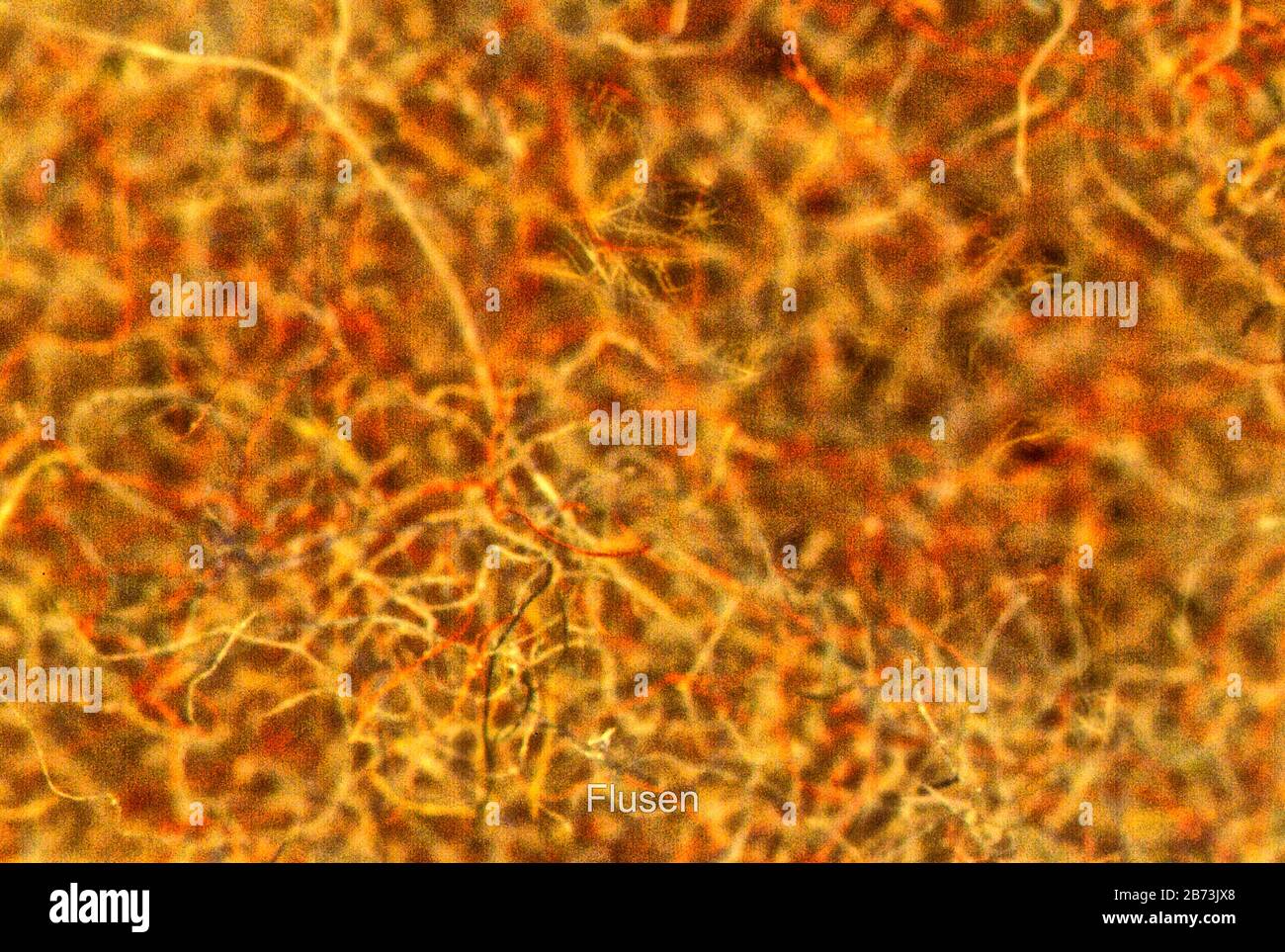 Dust threads hi-res stock photography and images - Alamy