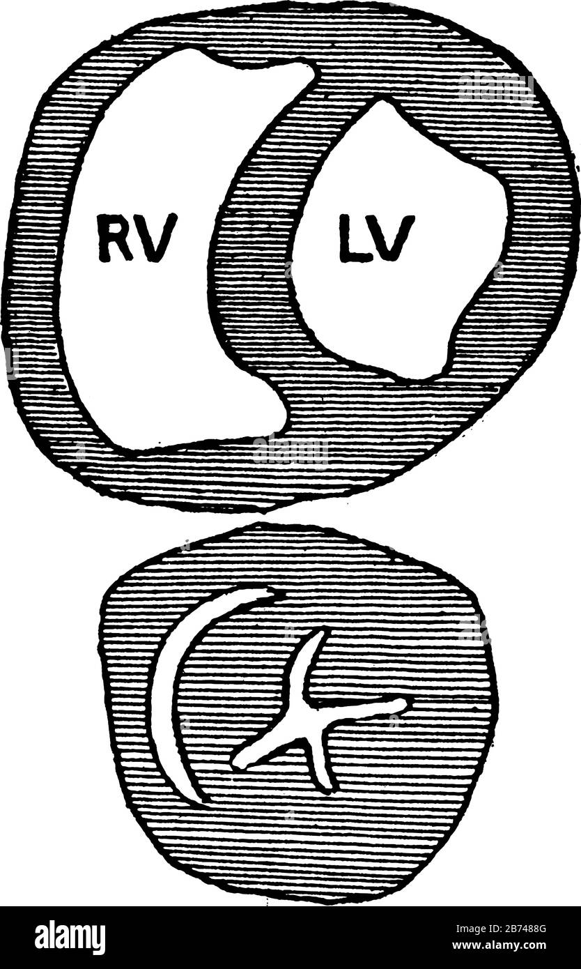 Transverse section through the middle of the ventricles of a dog's ...