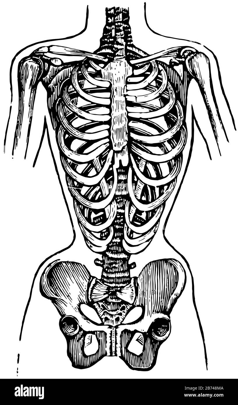 This illustration represents Deformed Chest, vintage line drawing or ...