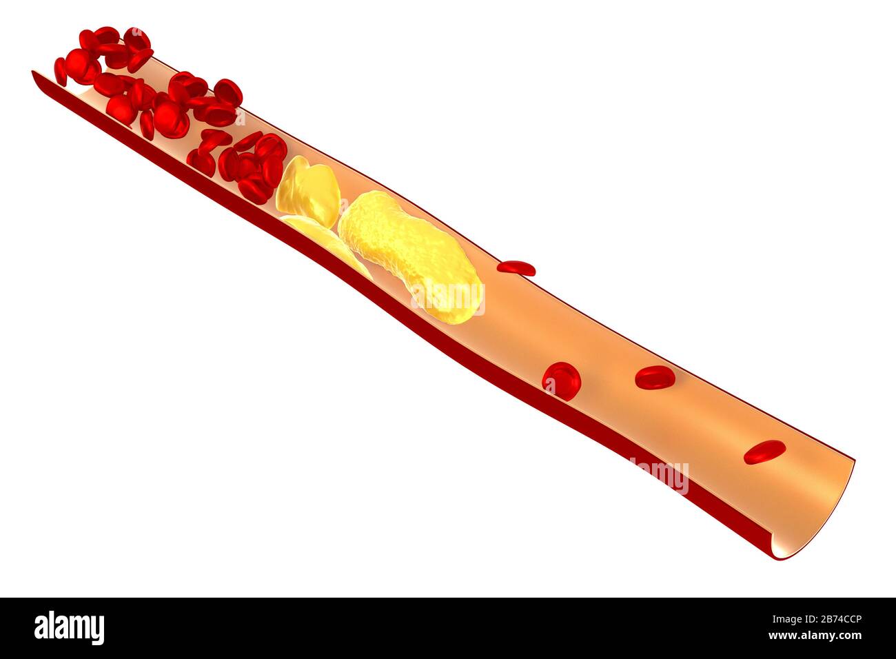 Cholesterol cells Cut Out Stock Images & Pictures - Alamy