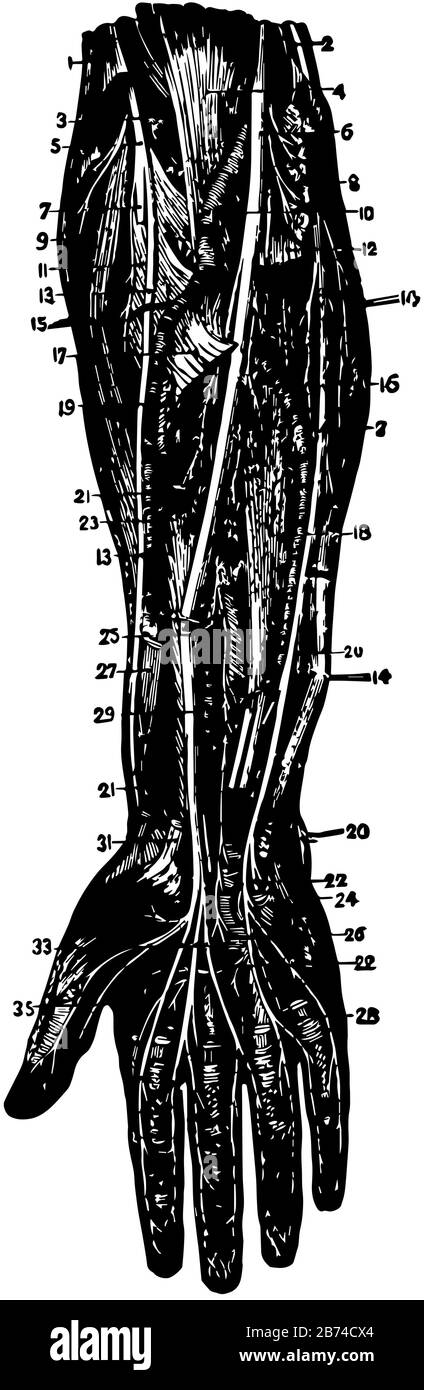 Deep dissection of the front of the forearm and hand showing the ...