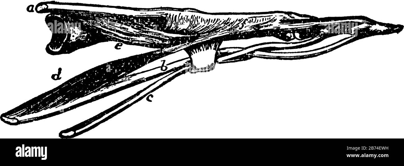 This diagram represents Tendons Attached to a Finger, vintage line ...