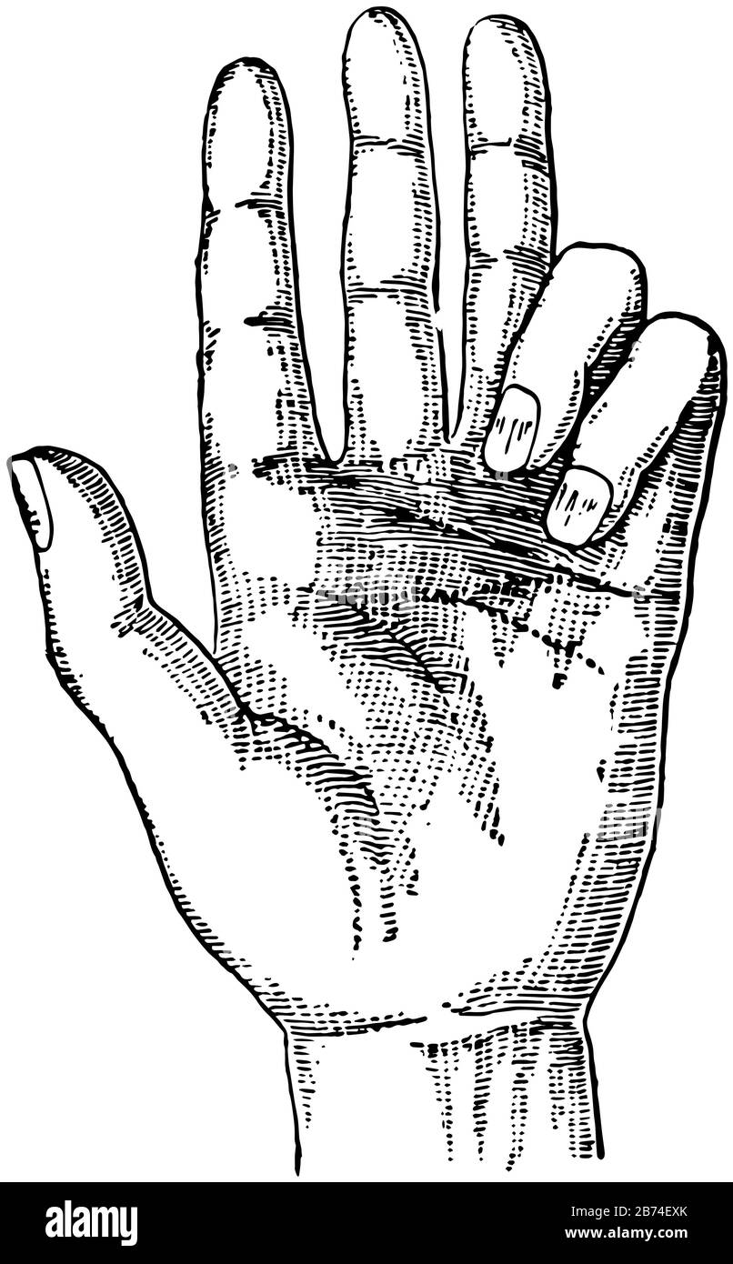 Hand with more than the normal number of fingers, vintage line drawing ...
