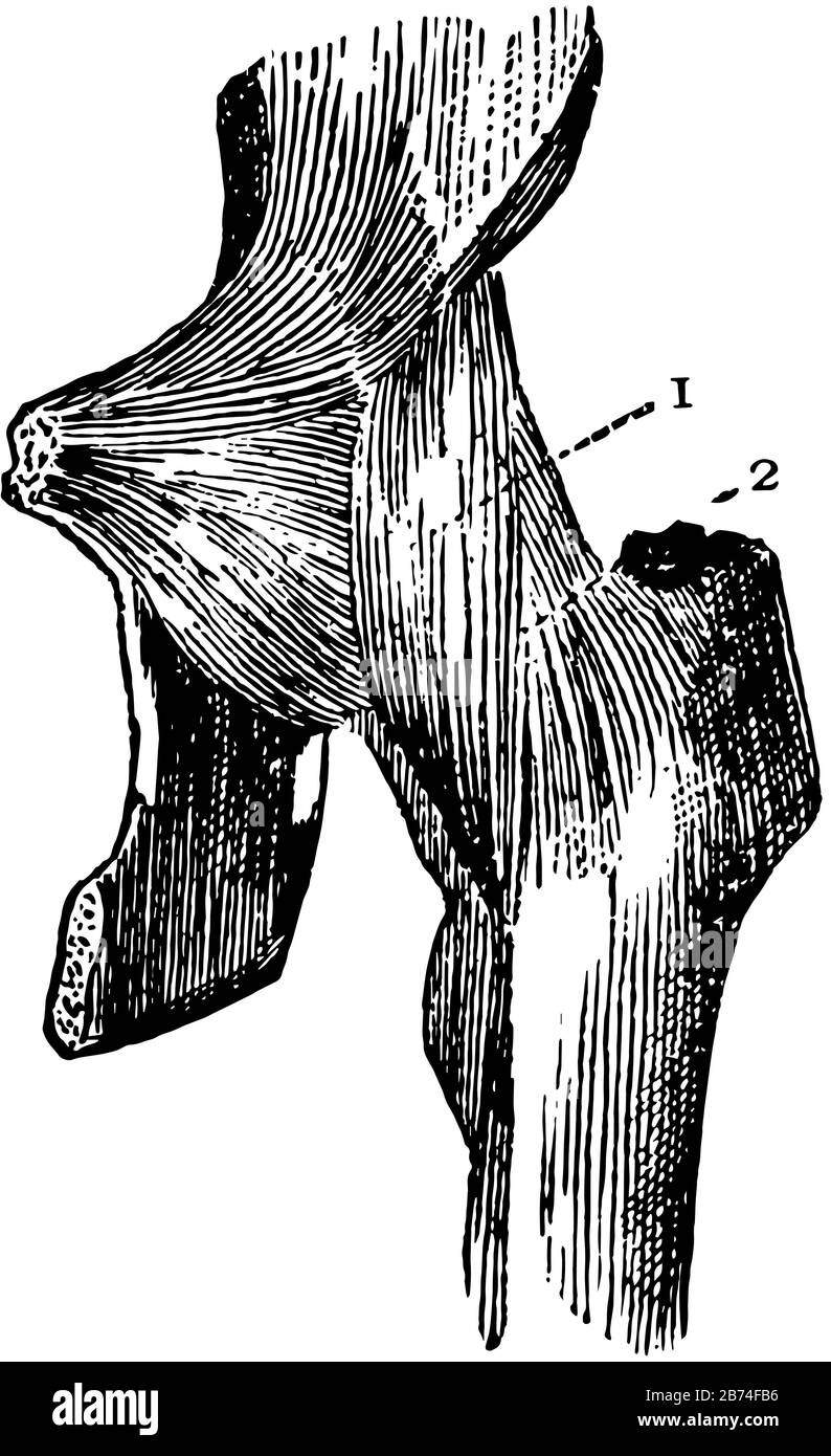 This illustration represents Hip Joint, vintage line drawing or ...