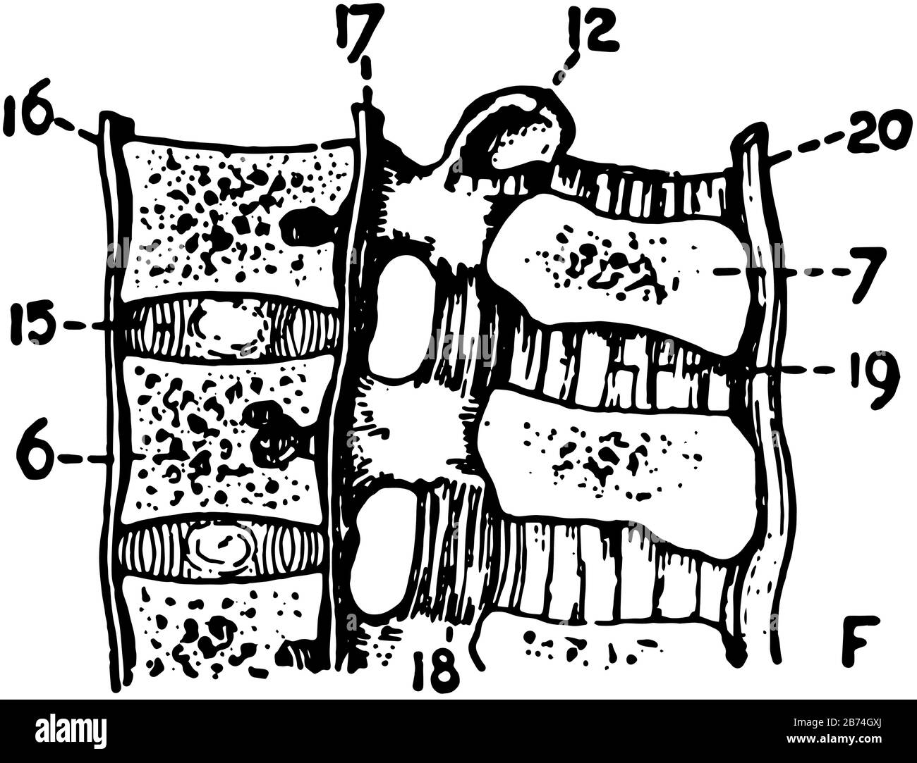 This illustration represents Lumbar vertebrae, vintage line drawing or ...
