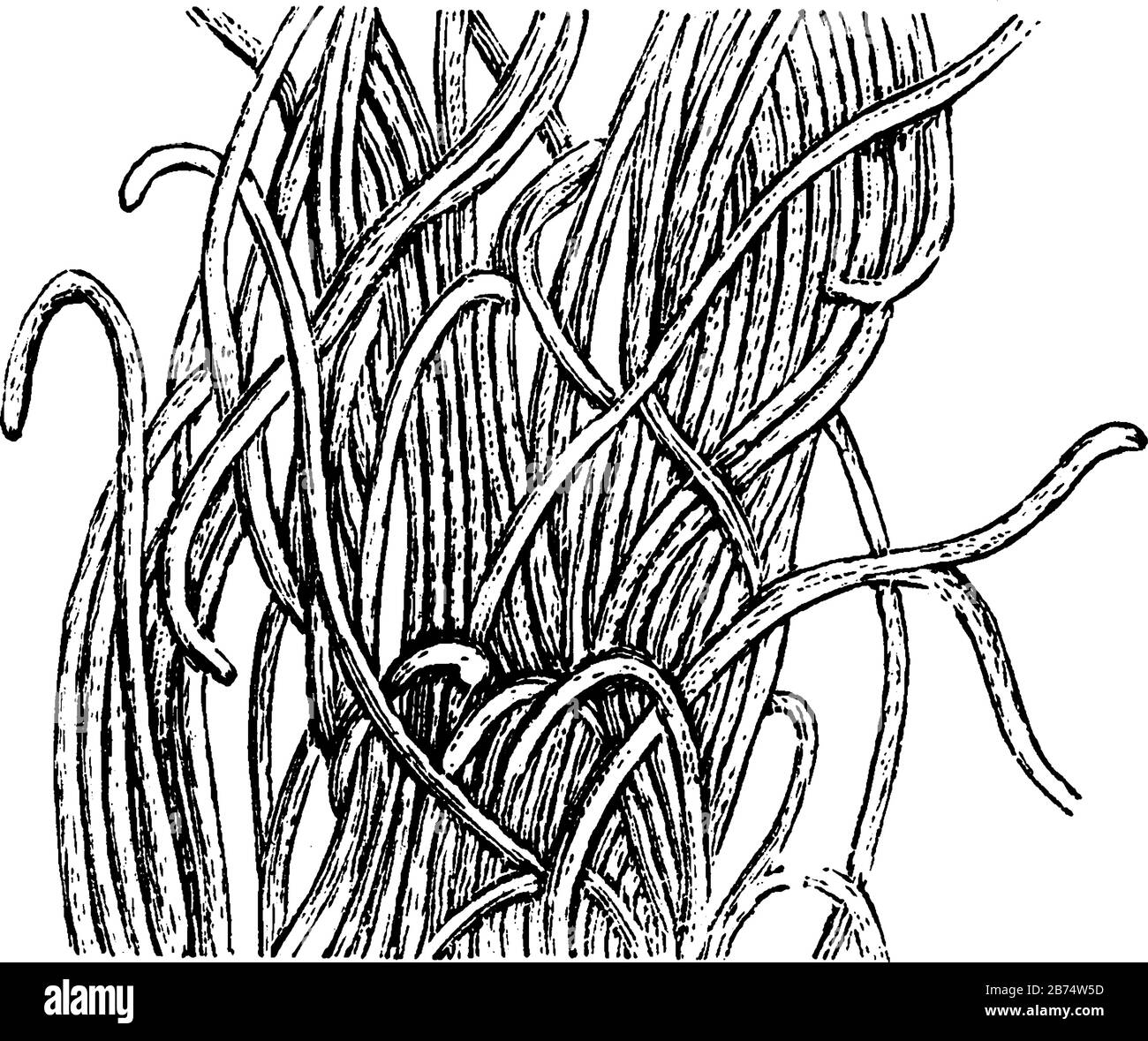 This diagram represents Yellow elastic tissue, vintage line drawing or ...
