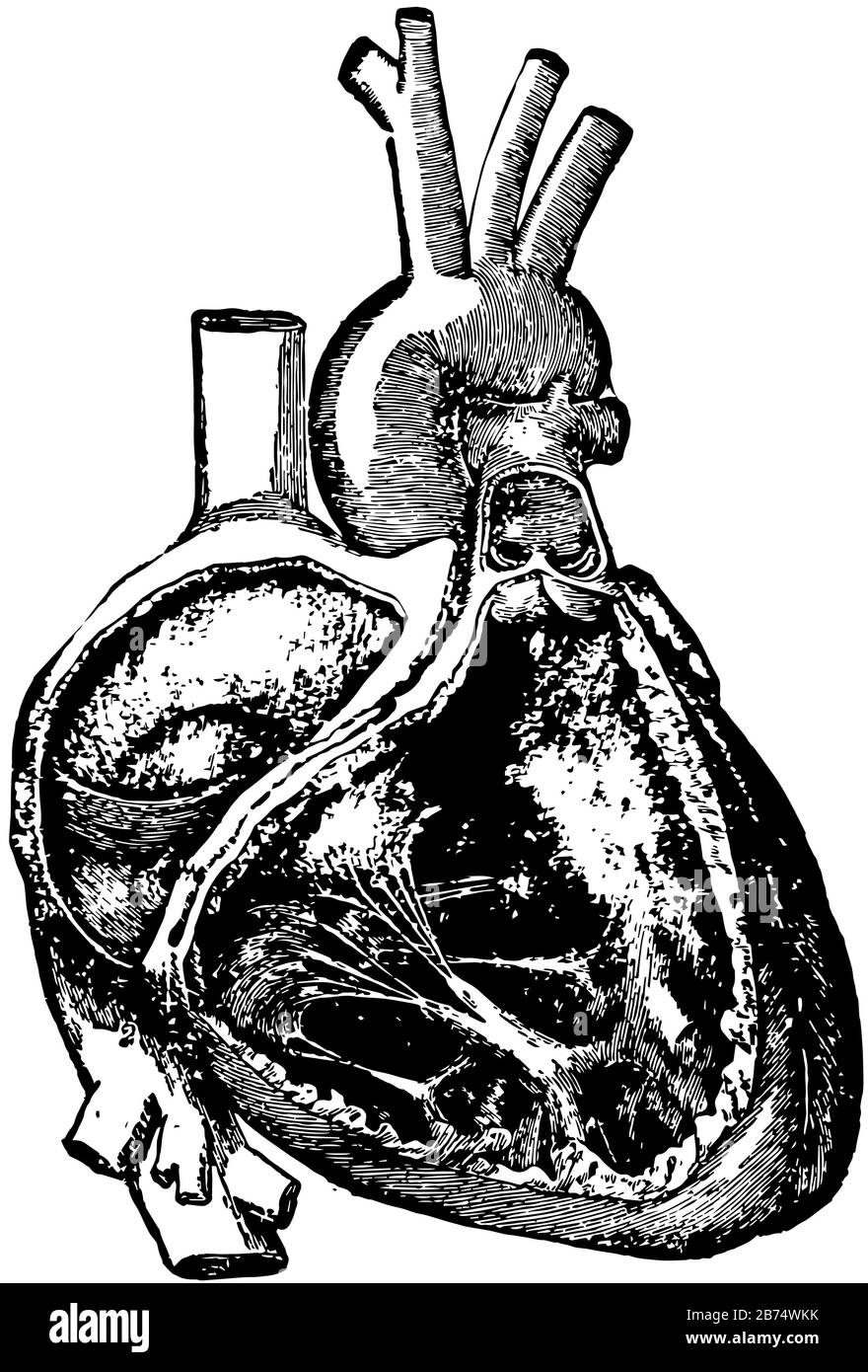 The cavities of the heart Black and White Stock Photos & Images - Alamy