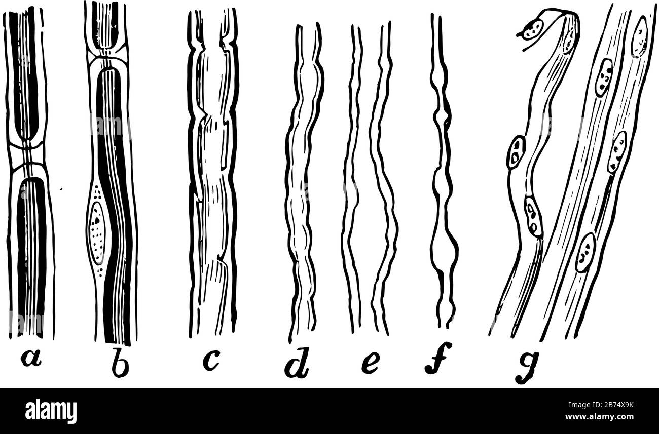 This illustration represents Nerve Fibers, vintage line drawing or ...