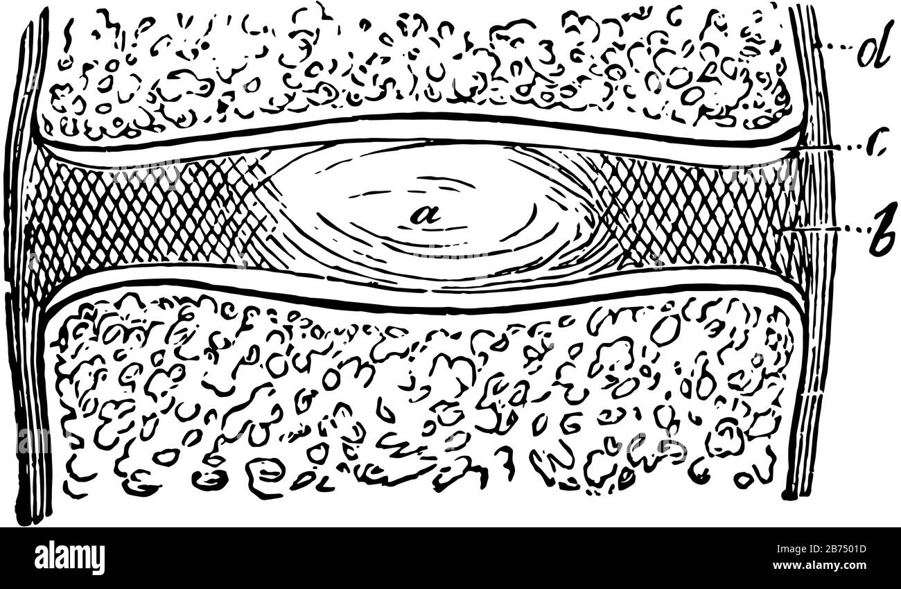 This illustration represents Human Joint Mixed Articulation, vintage ...