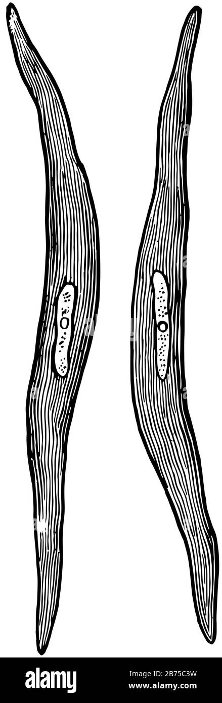 Fiber-cells of plain muscular tissue is highly magnified, vintage line ...