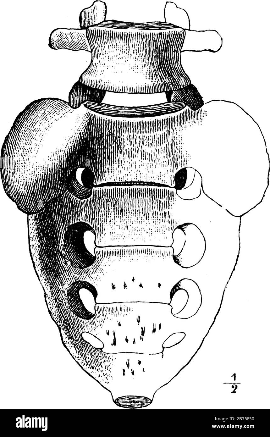 This illustration represents Lumbar and Sacrum of Spine, vintage line ...