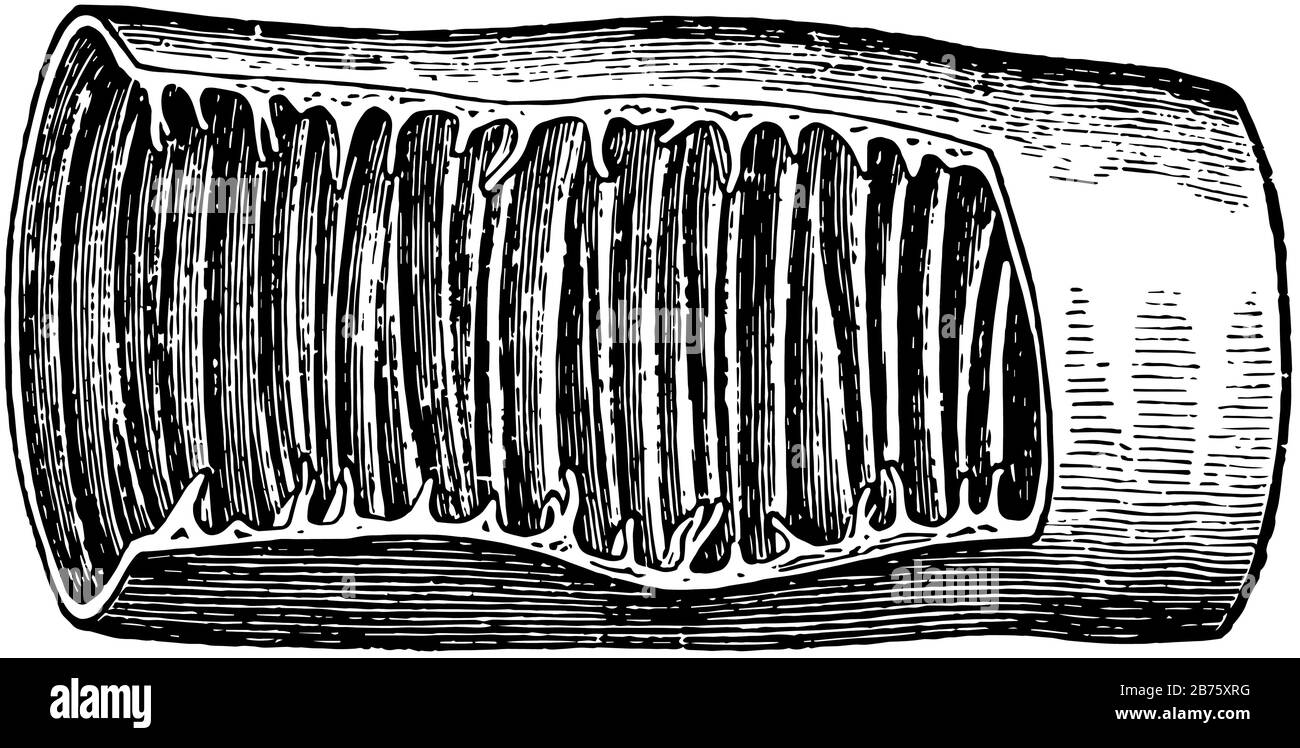 Small intestine drawing hi-res stock photography and images - Alamy