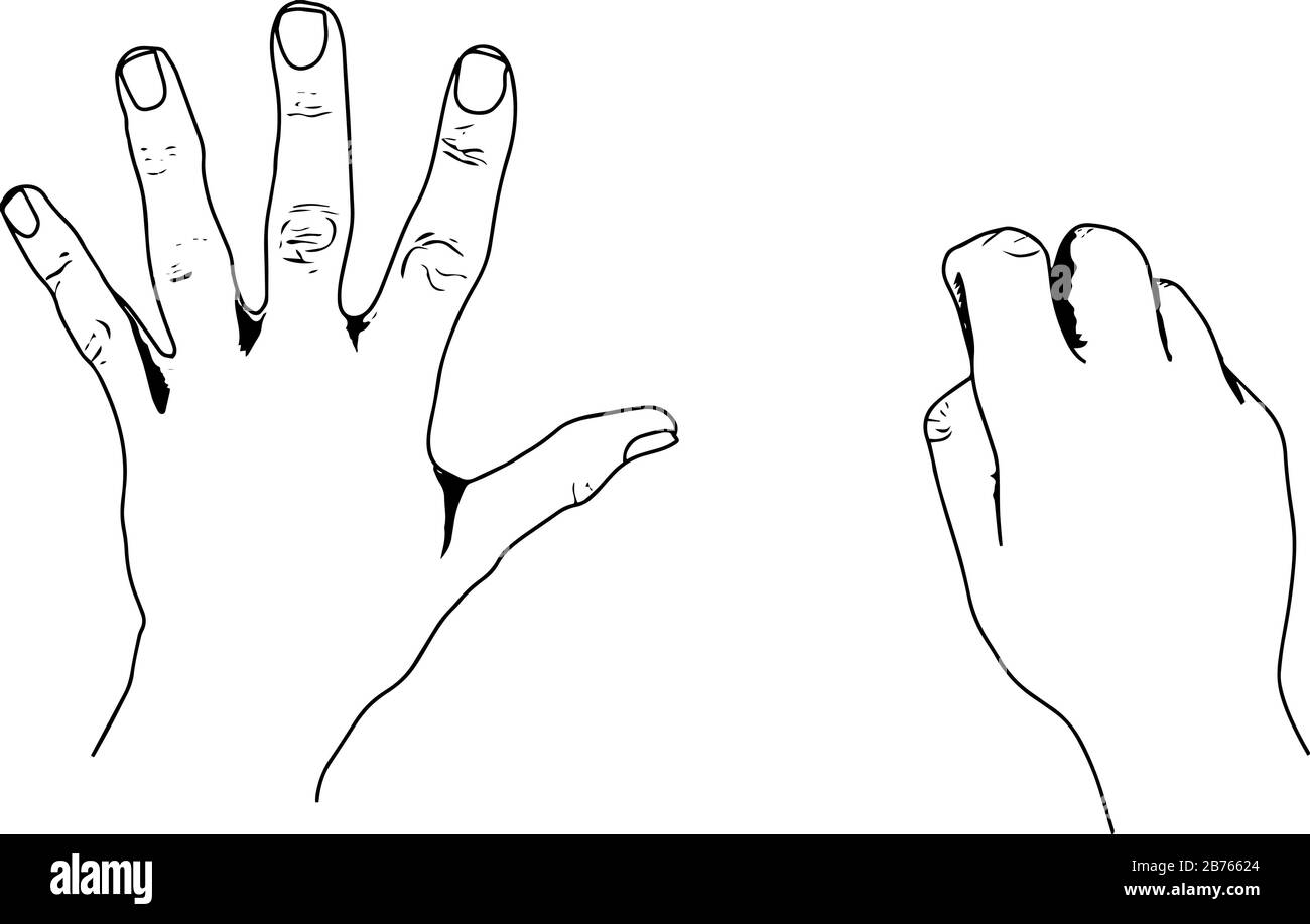 European Style Counting Hands depicting 5 in European Style, vintage ...