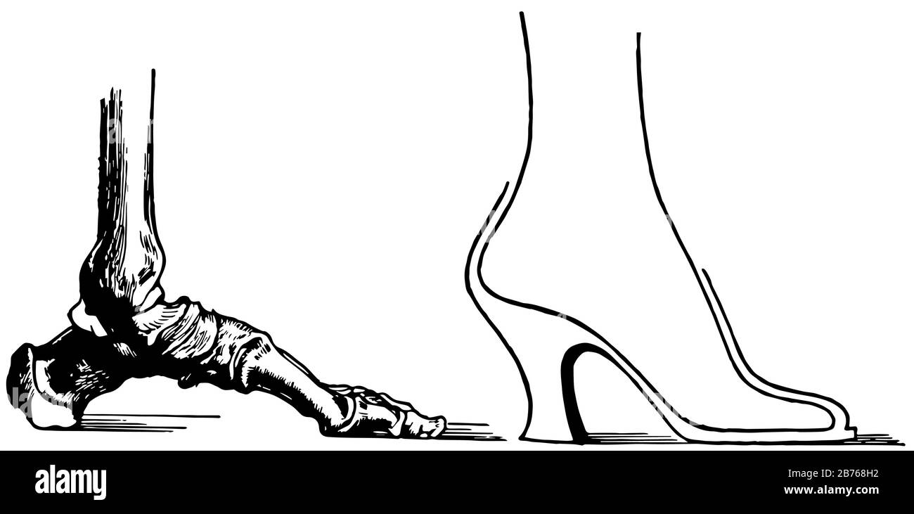 High end vector vectors Black and White Stock Photos & Images - Alamy