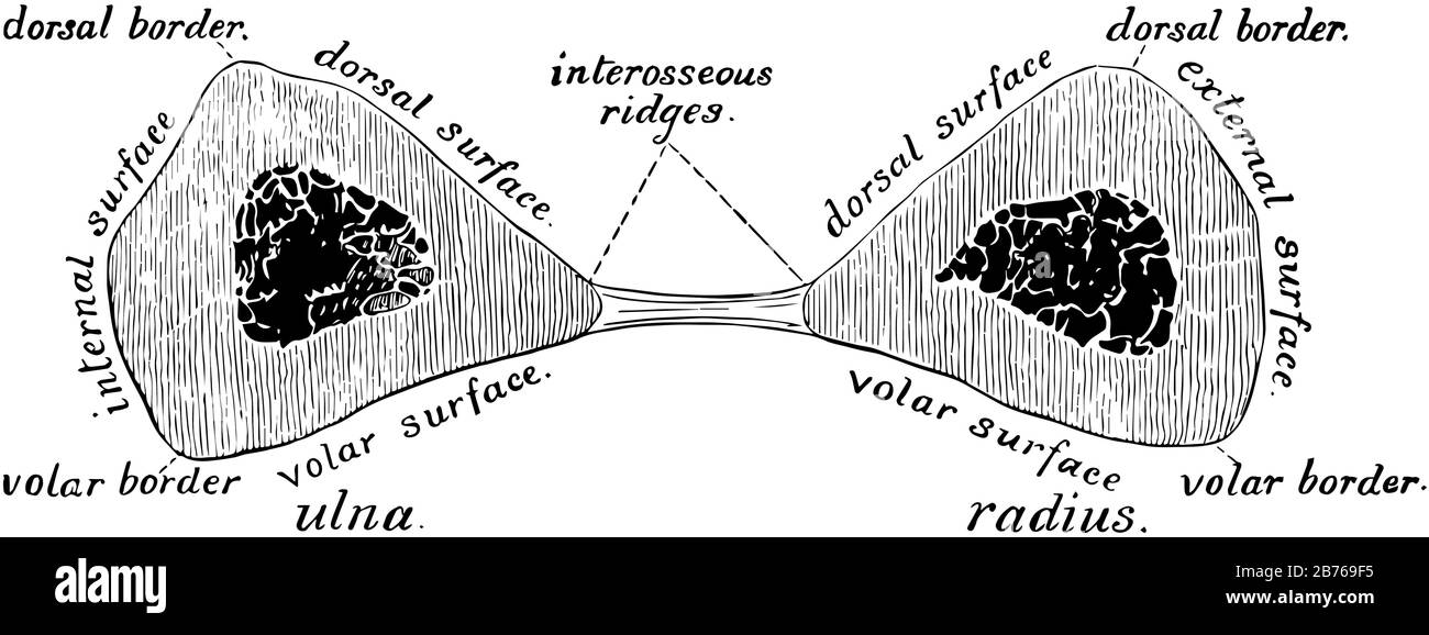This illustration represents Forearm Bones, vintage line drawing or ...
