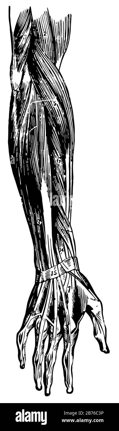 This illustration represents Back Forearm Muscles, vintage line drawing ...