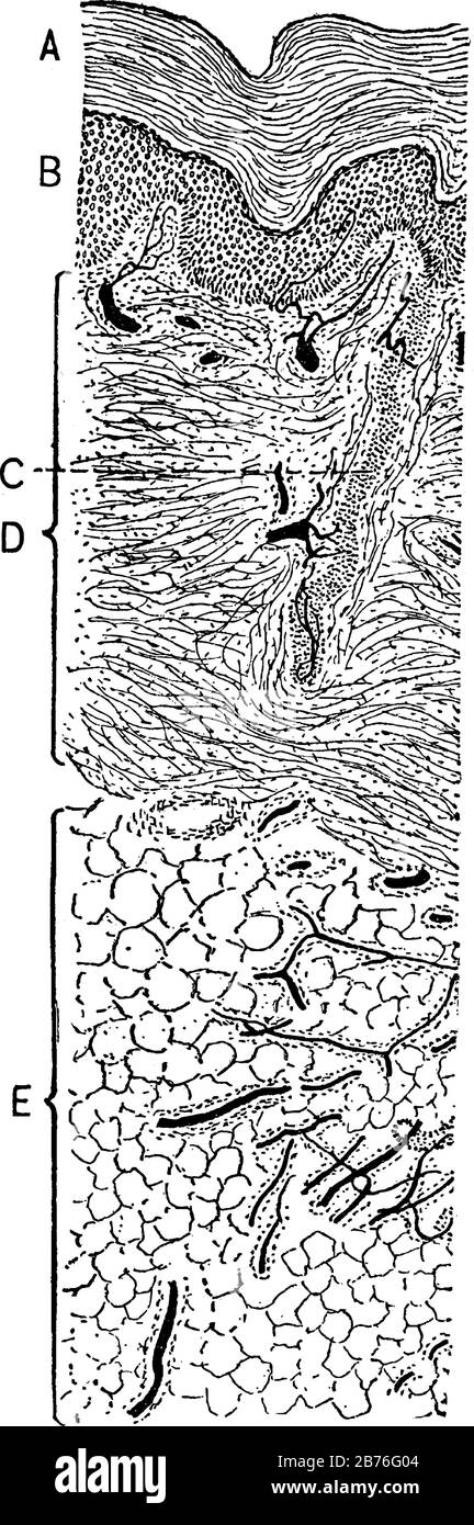 This illustration represents Cross Section of the Skin, vintage line ...