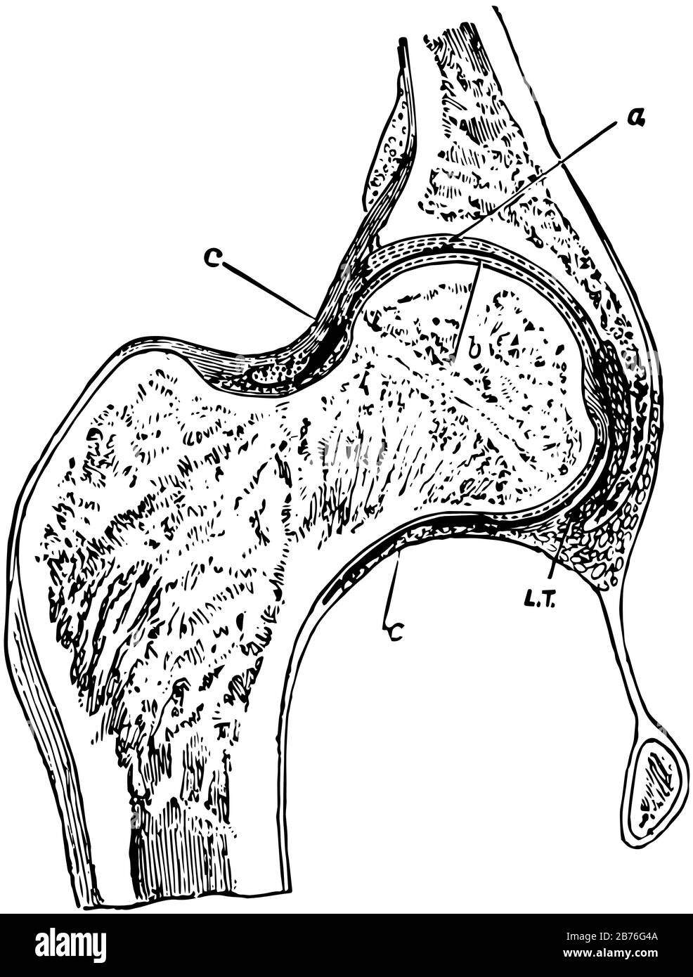 Hip joint section Stock Vector Images - Alamy