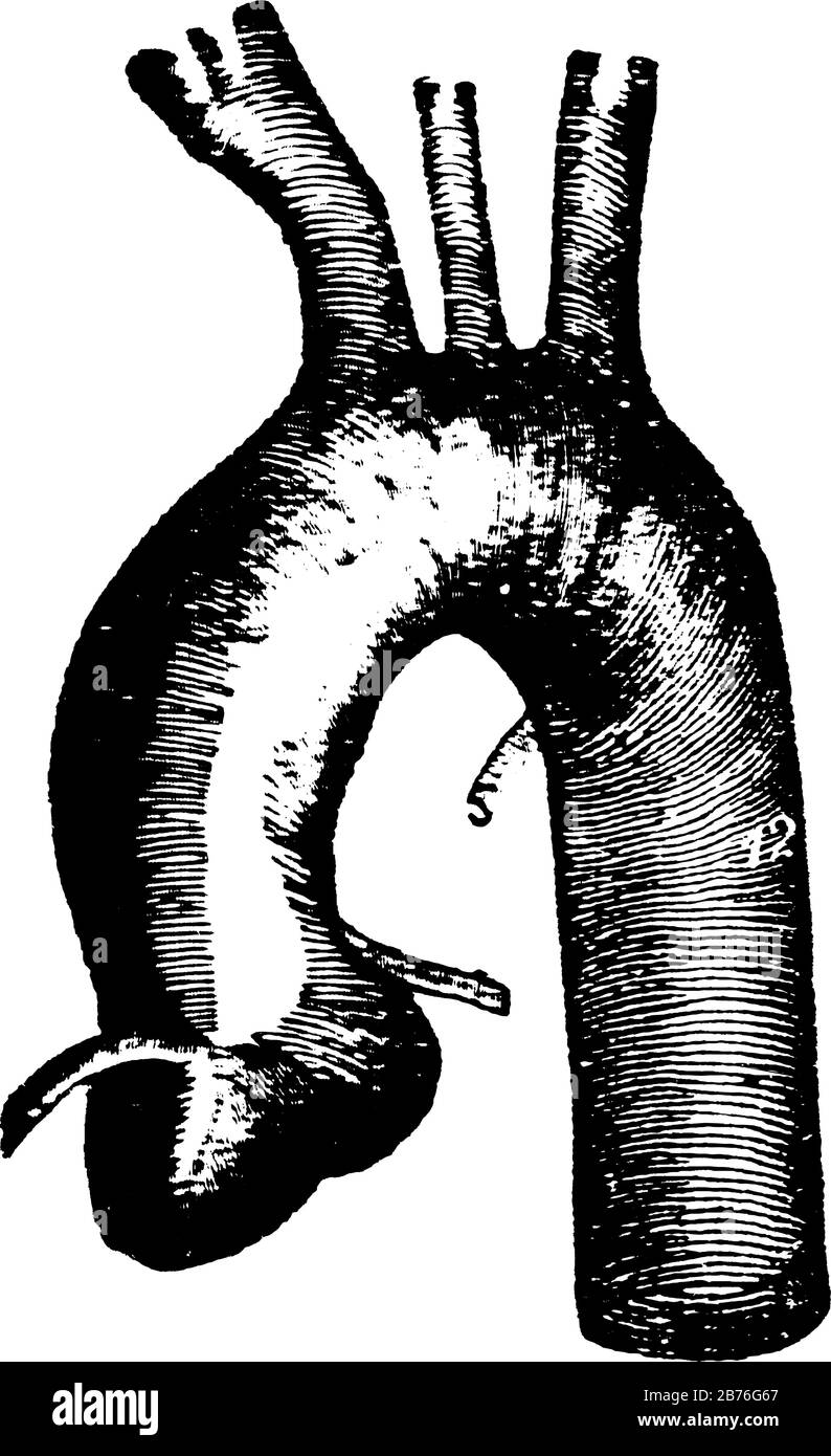 This diagram represents a Thoracic Aorta, vintage line drawing or ...