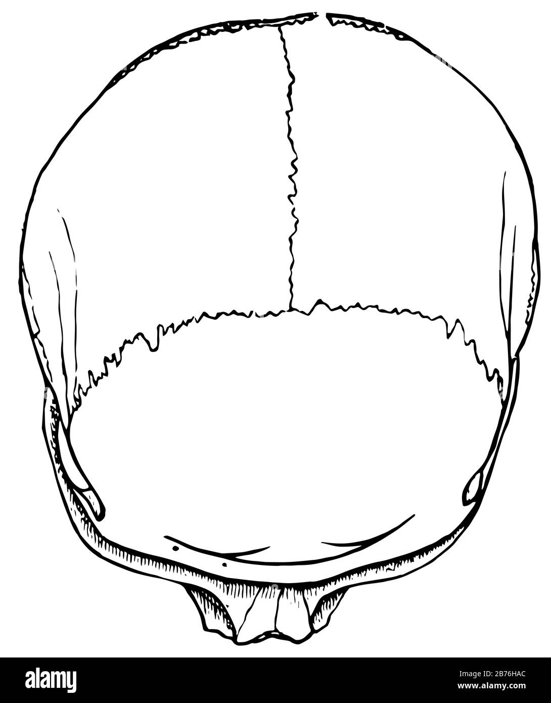 This illustration represents Brachycephalic Cranium, vintage line ...