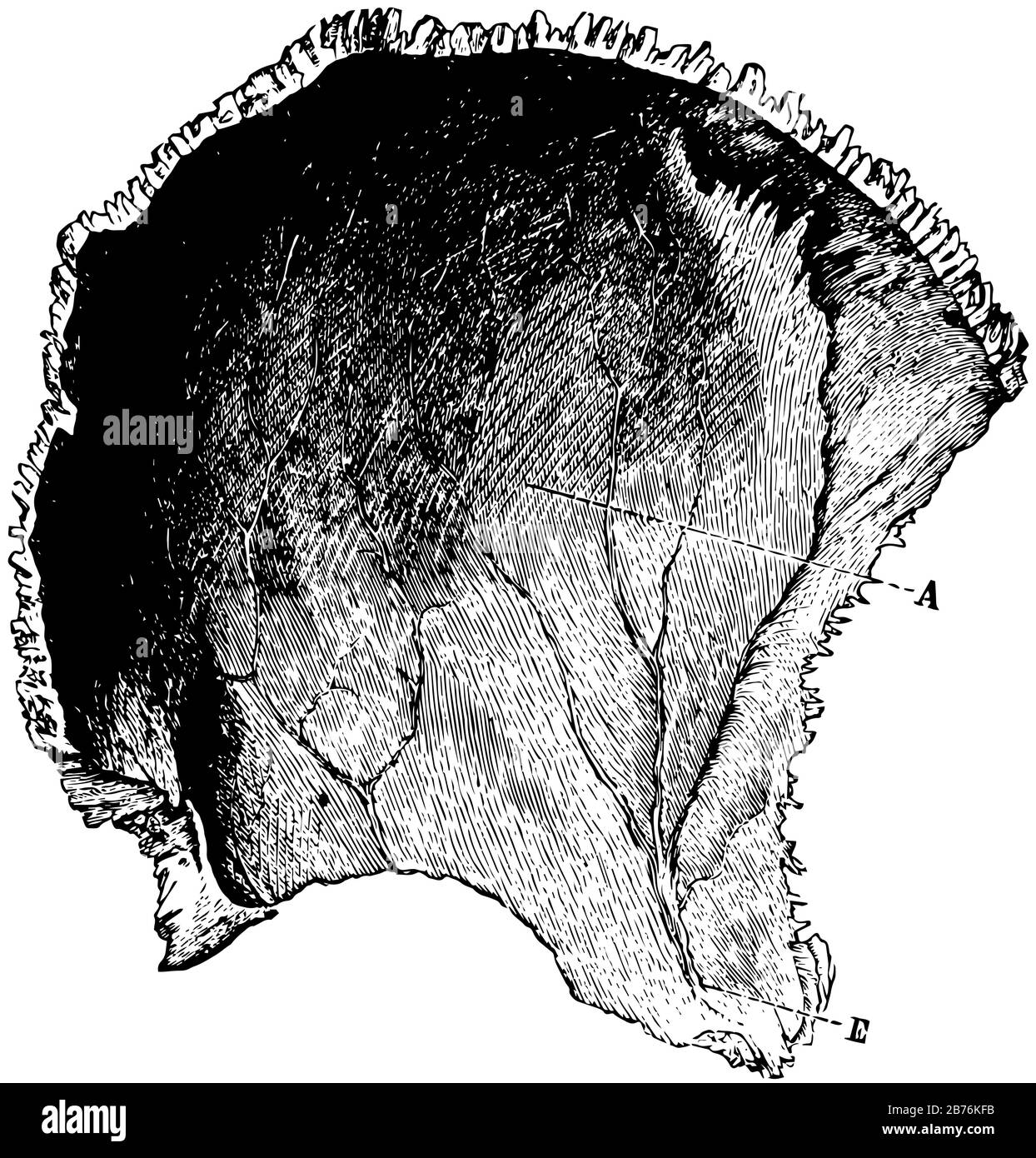 Parietal bone hi-res stock photography and images - Alamy