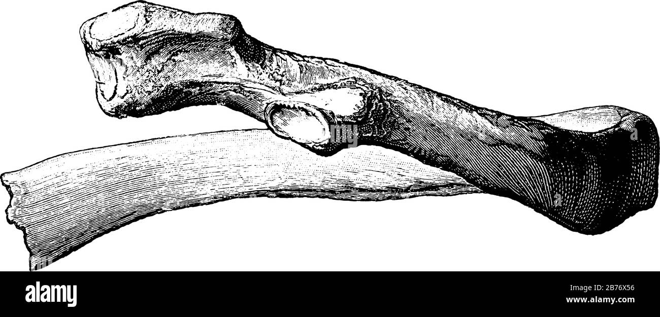 This picture depicts long and curved bones near the abdomen which ...