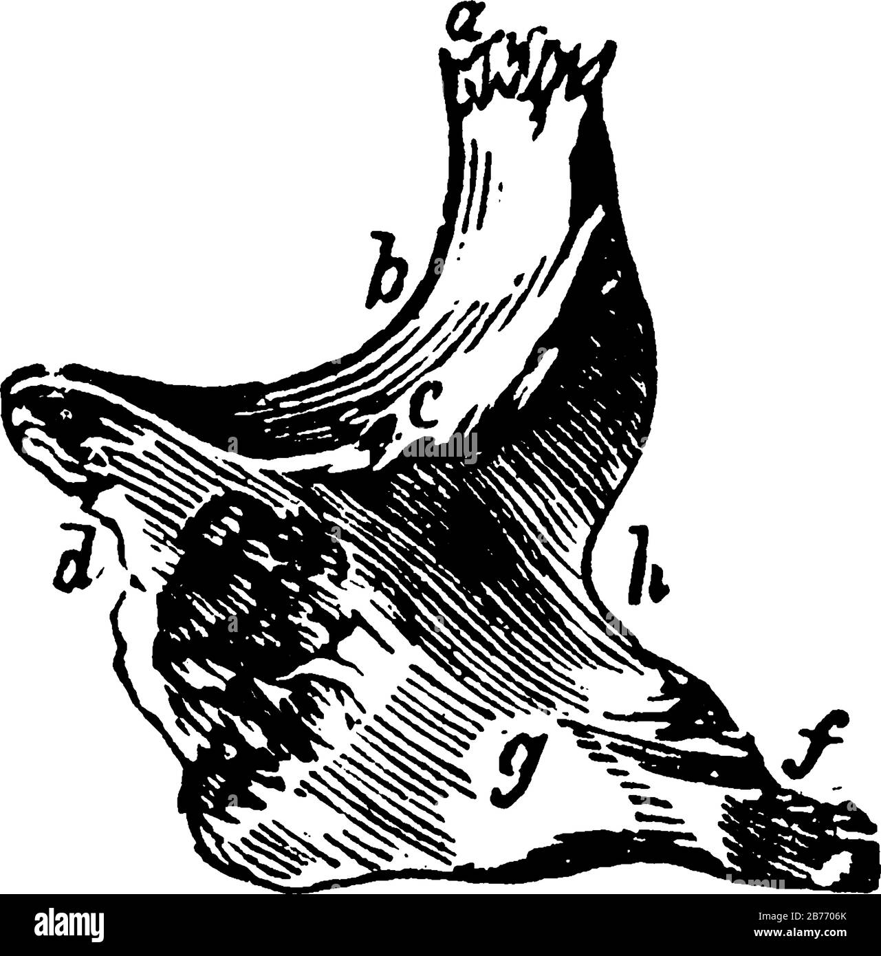 Malar bone or cheek bone is a bone on each side of the face below the ...