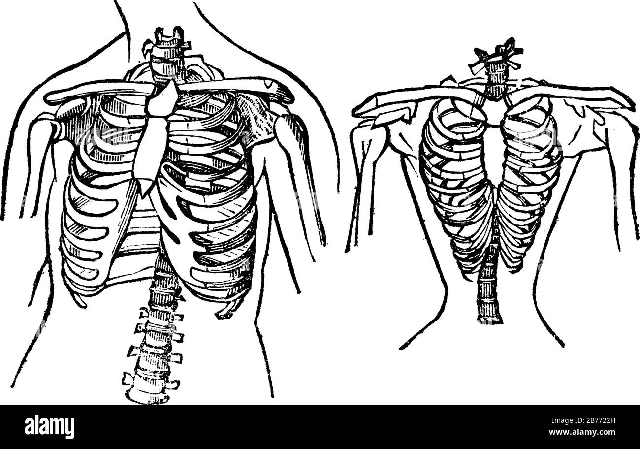 The left figure represents the natural shape of the chest, and that ...