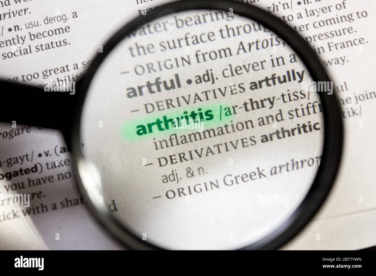 Artritis hi-res stock photography and images - Alamy
