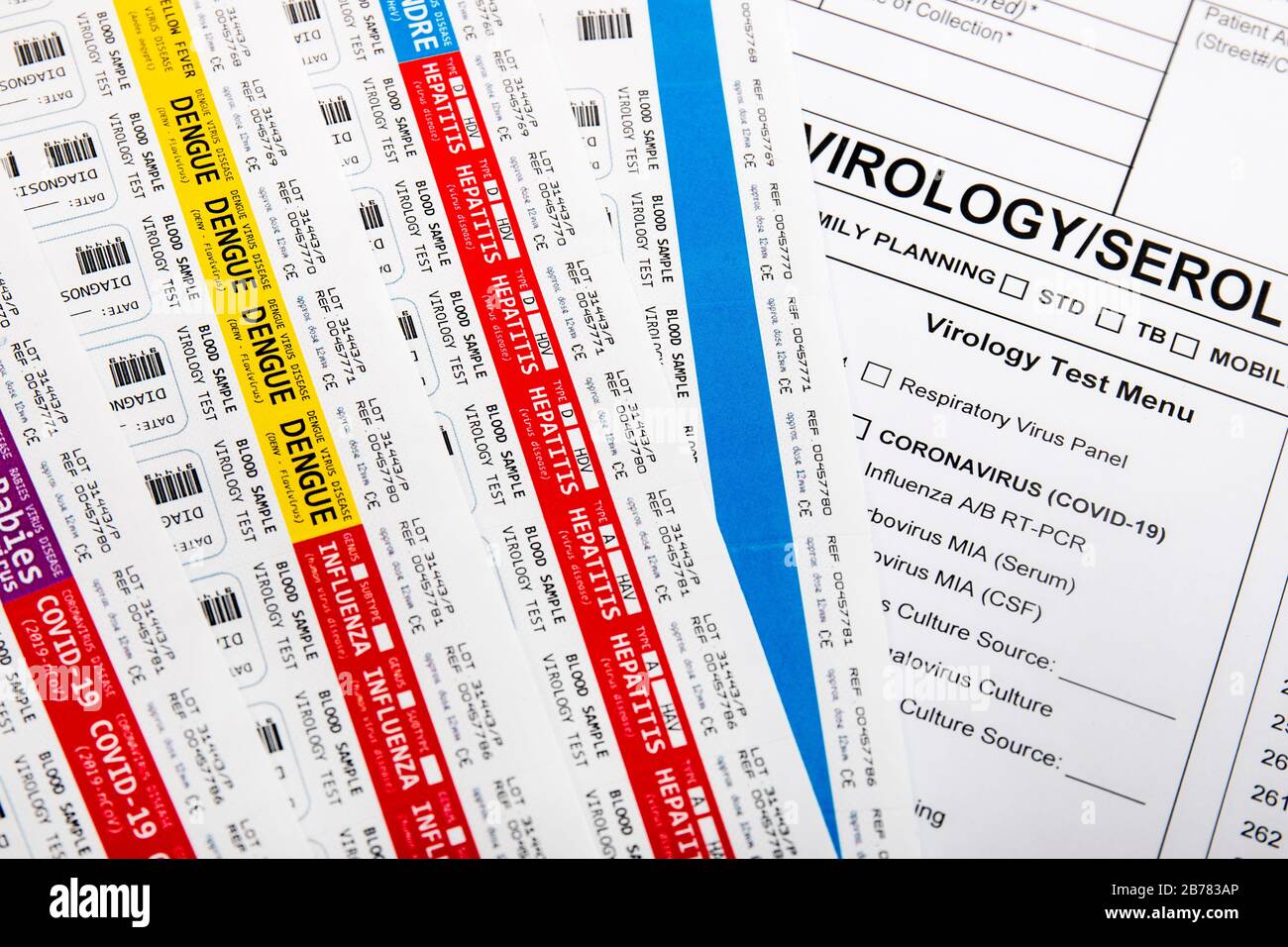 Several labels of various virus and laboratory test report concept, for ...