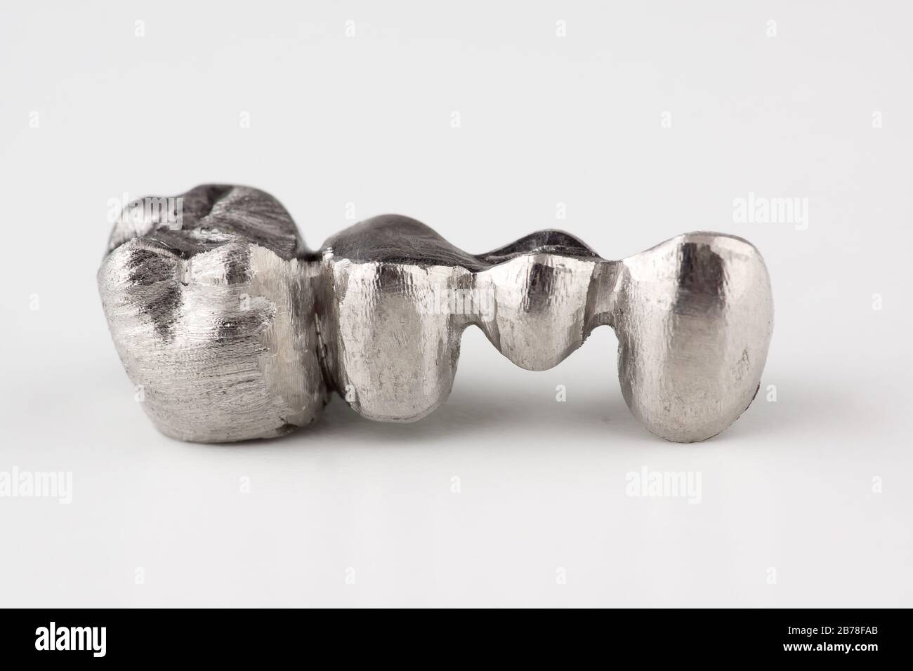Steel artificial dental crown for dentition restoration Stock Photo - Alamy