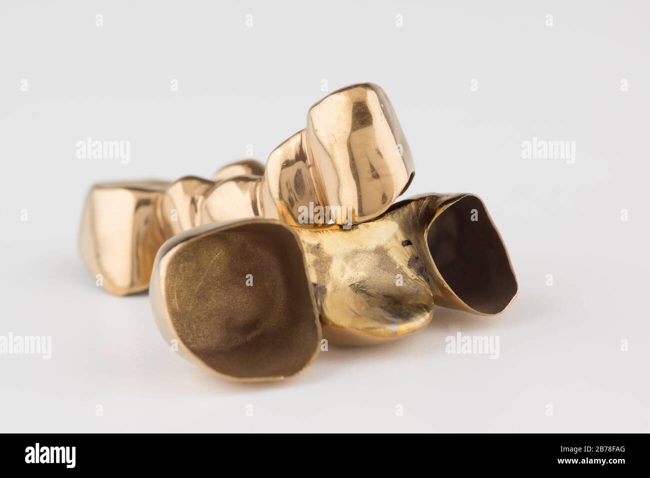 Steel artificial dental crown for dentition restoration Stock Photo - Alamy