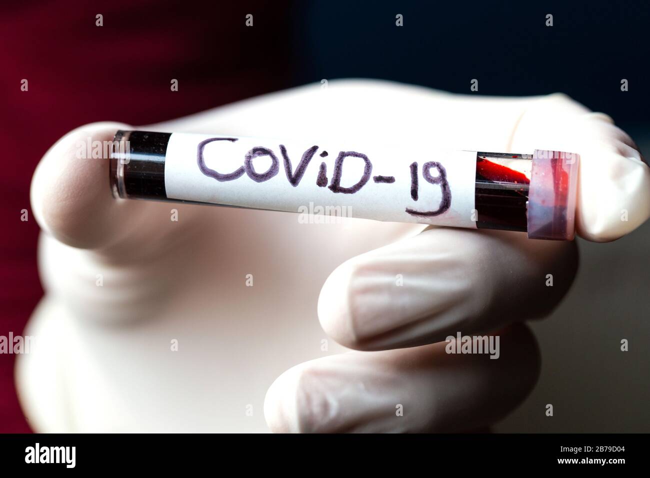 Covid-19 blood sample, doctor wearing medical gloves holding a blood ...
