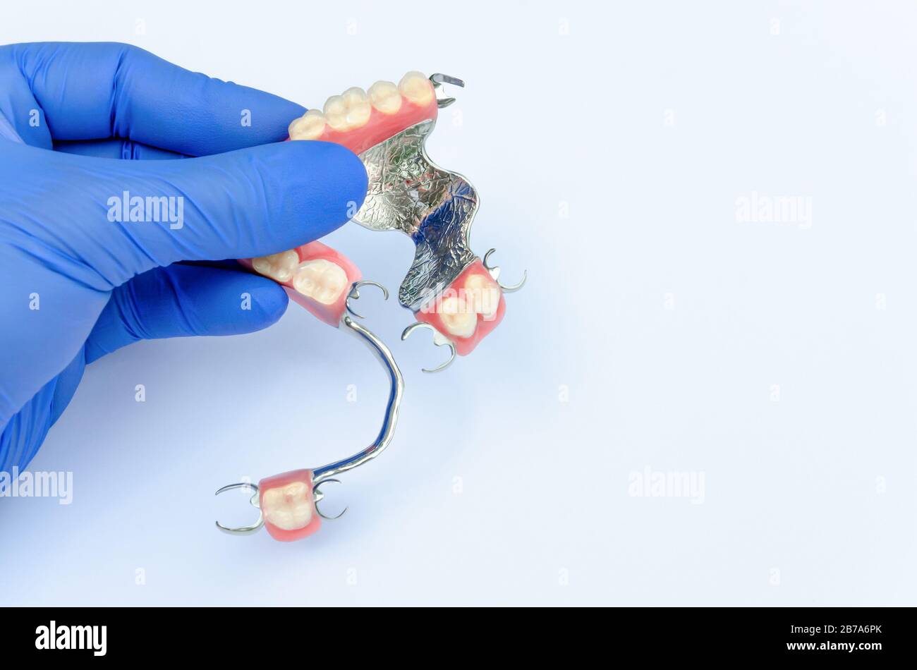 orthopedic dentistry. prosthetics concept with removable dentures. a ...