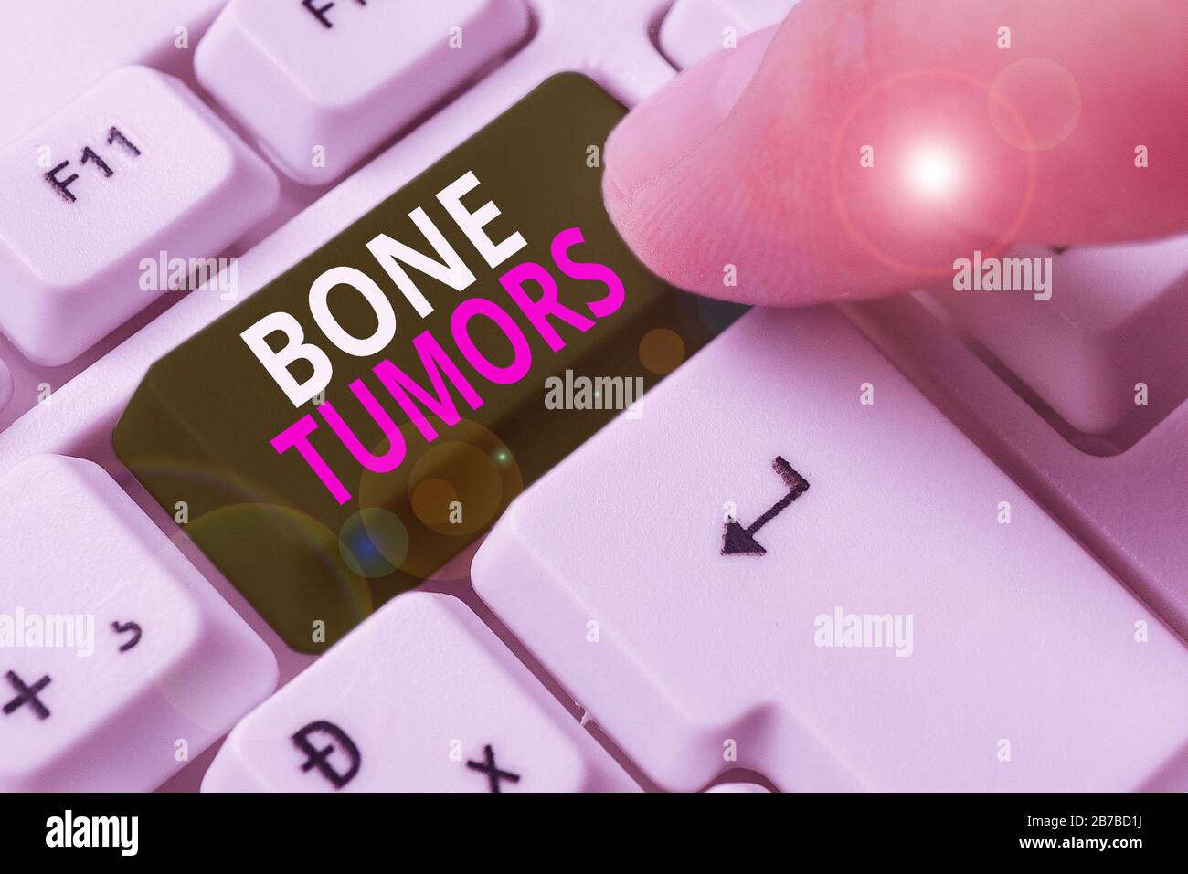 Word writing text Bone Tumors. Business photo showcasing can be either ...
