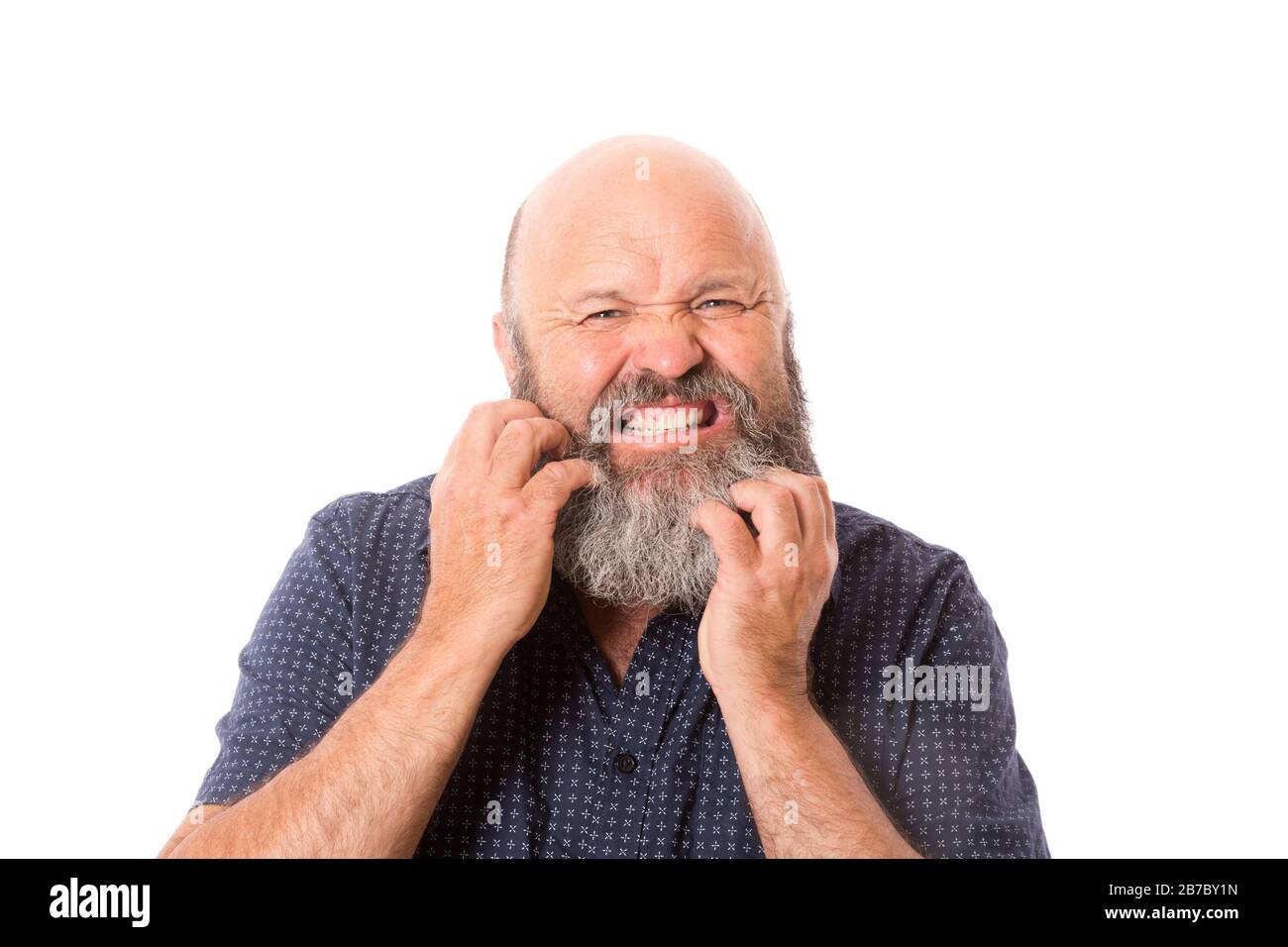 Psoriasis face hi-res stock photography and images - Alamy