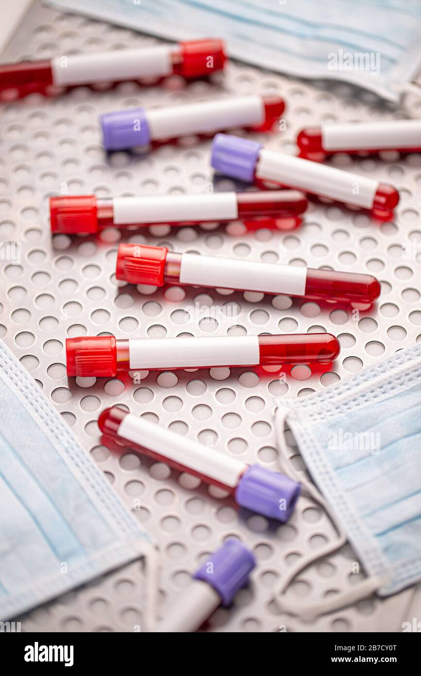 Test tubes with blood samples on metal surface Stock Photo - Alamy